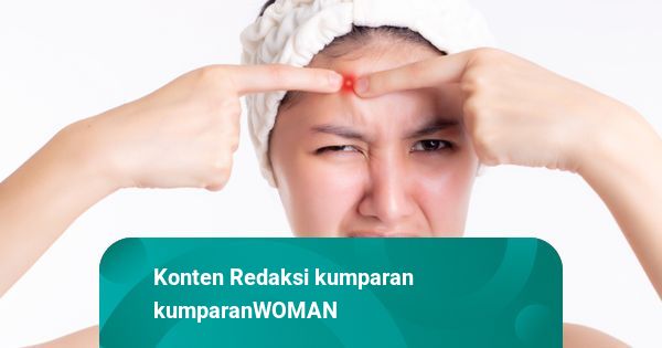 Jerawat Hormonal vs Jerawat Bakteri, Ketahui Perbedaan & Kiat ... Jerawat Hormonal vs Jerawat Bakteri, Ketahui Perbedaan & Kiat ...
